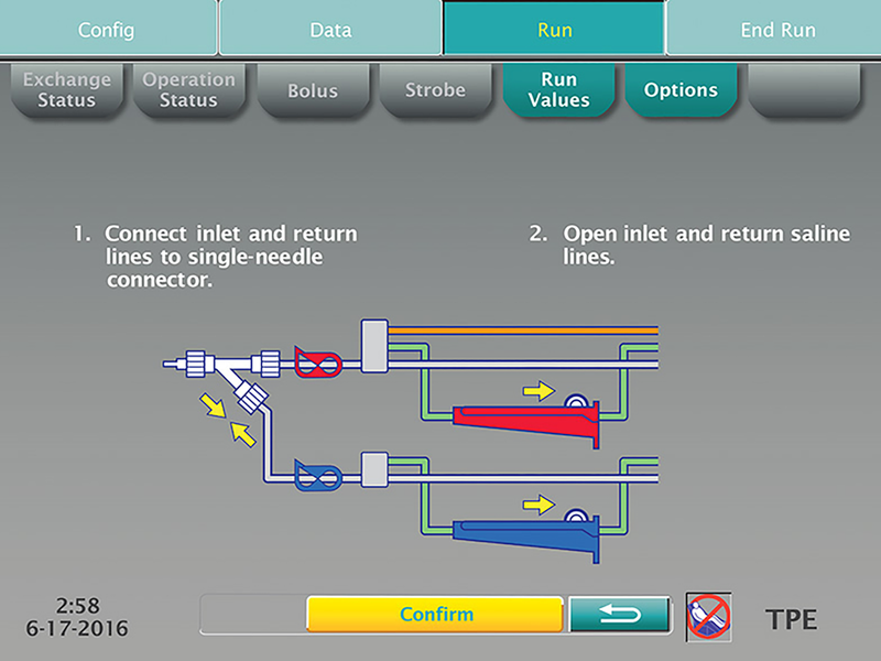 Therapeutic Plasma Exchange (TPE)