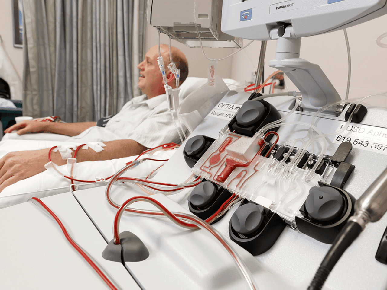 Therapeutic Plasma Exchange for Neurology