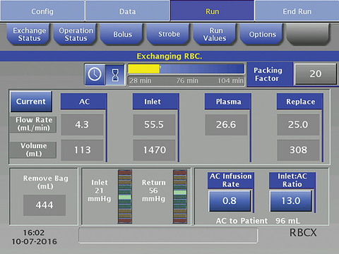 Therapeutic Plasma Exchange (TPE)